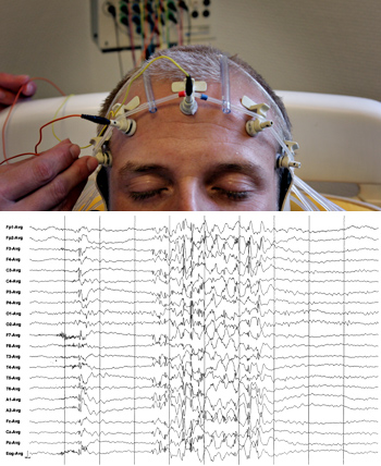 Neurological Treatment in Dubai - GNC German Neurologists