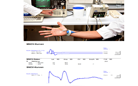 NCV (Nerve conduction velocity), GNC, German Neuroscience Center (Neurology, Psychiatry ...