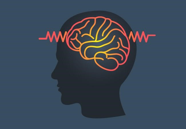 Status Epilepticus: Causes, Symptoms and Treatment in Dubai