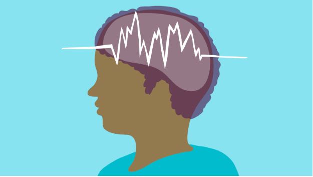 Epilepsy: Causes, Symptoms and Treatments